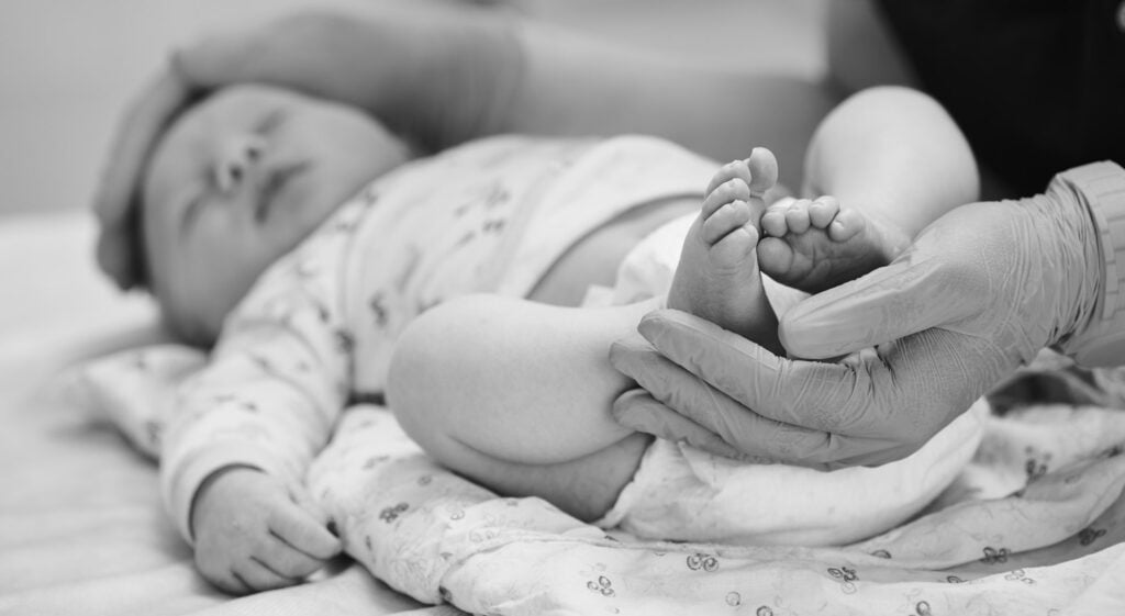 Neonatal Surgery - Dr. S. Singh